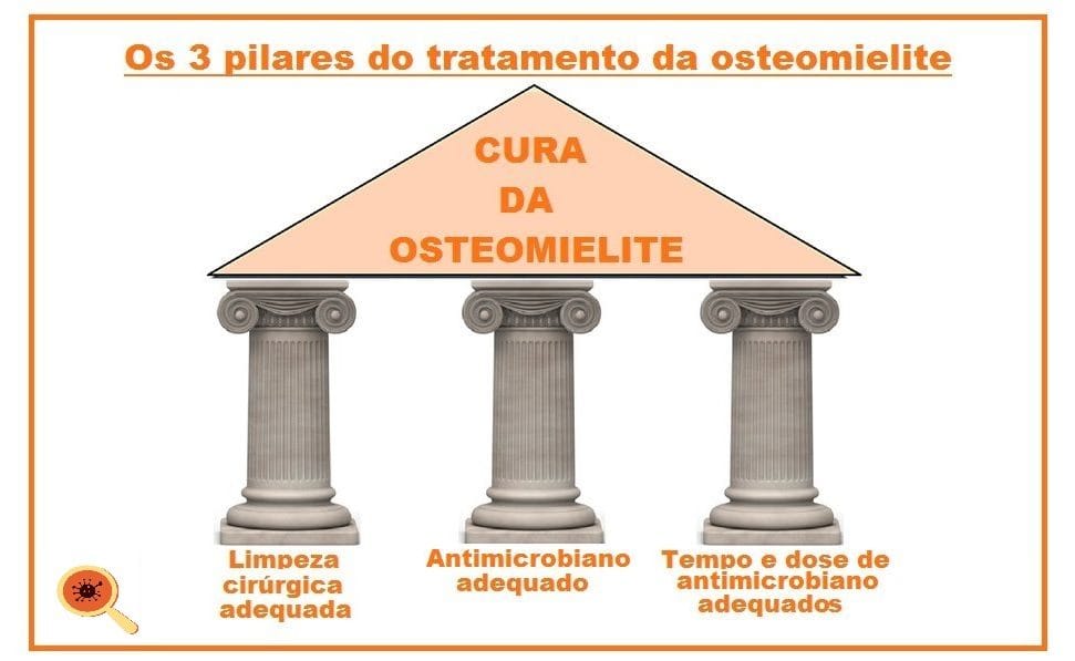 Osteomielite: Saiba Mais Sobre Ela - Dra. Keilla Freitas Infectologista