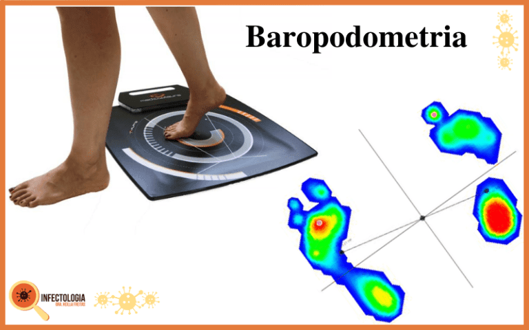 Pé diabético: Conheça Mais Informações | Dra. Keilla Freitas - Dra ...