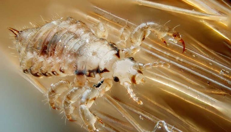 Pediculose: Recomendações para Evitar e Tratar - Dra keilla Freitas